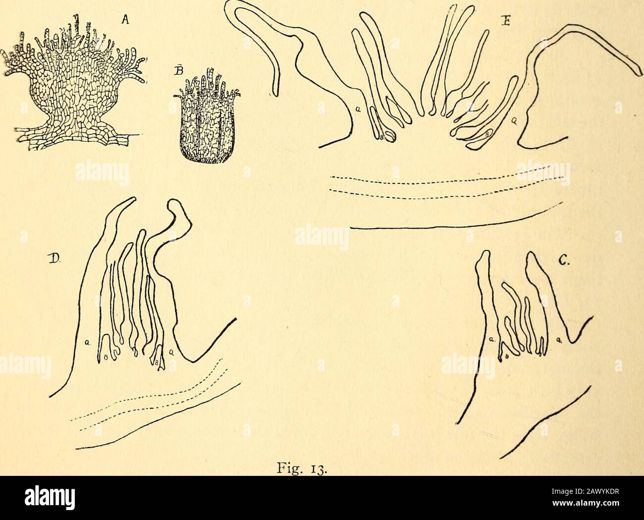 Axial cross section hi-res stock photography and images - Alamy