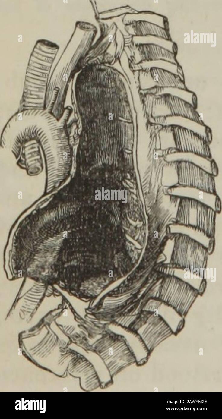 Recumbent posture hi-res stock photography and images - Alamy
