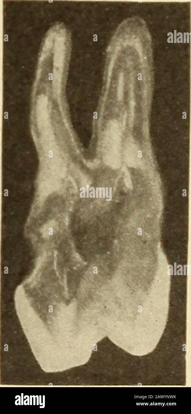 Silver nitrate solution hi-res stock photography and images - Alamy