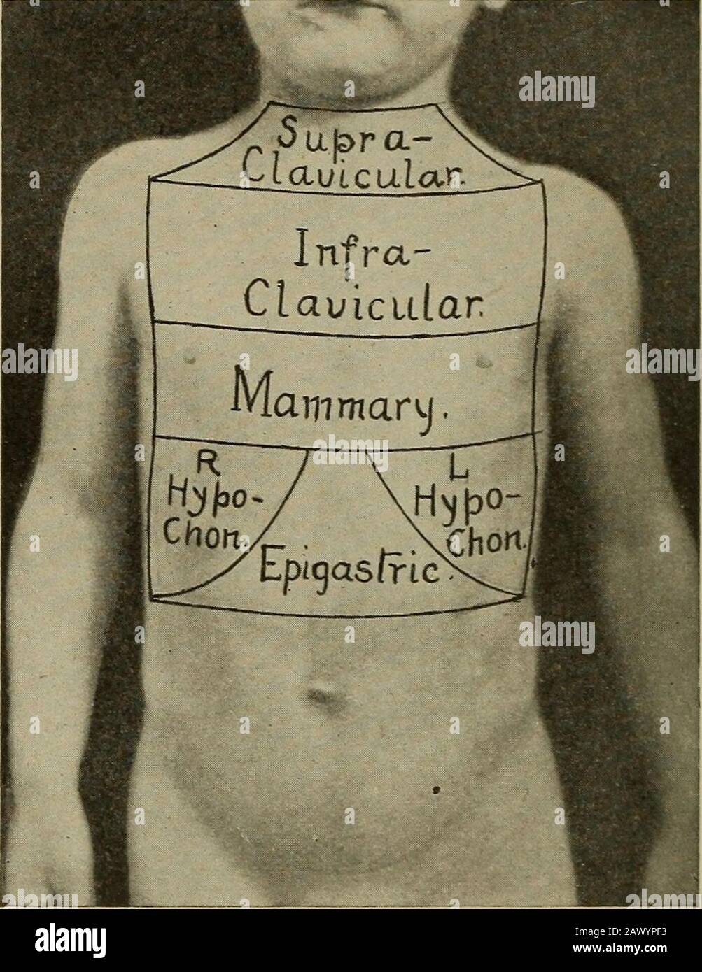 Spasmodic croup hi-res stock photography and images - Alamy
