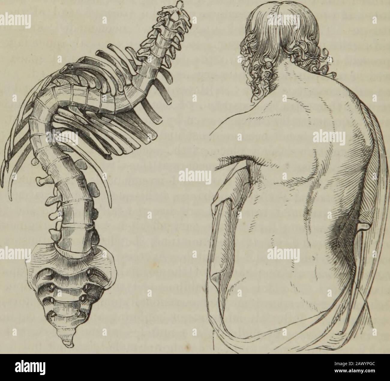 The practice of surgery . rigid and contracted state of thesterno ...
