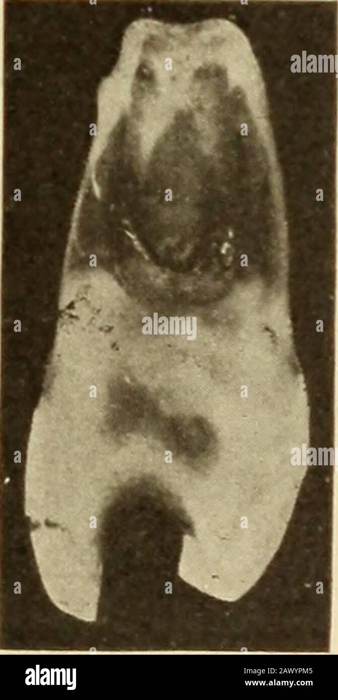 Diseases of the soft structures of the teeth and their treatment; a ...