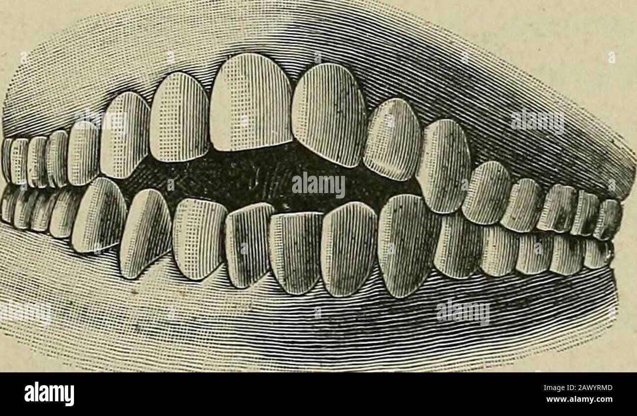 The etiology of osseous deformities of the head, face, jaws and teeth ...