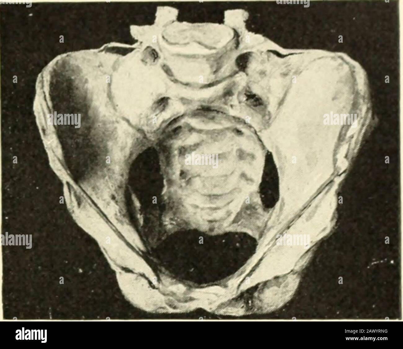 A textbook of obstetrics . so of the transverse,by the methods of ...
