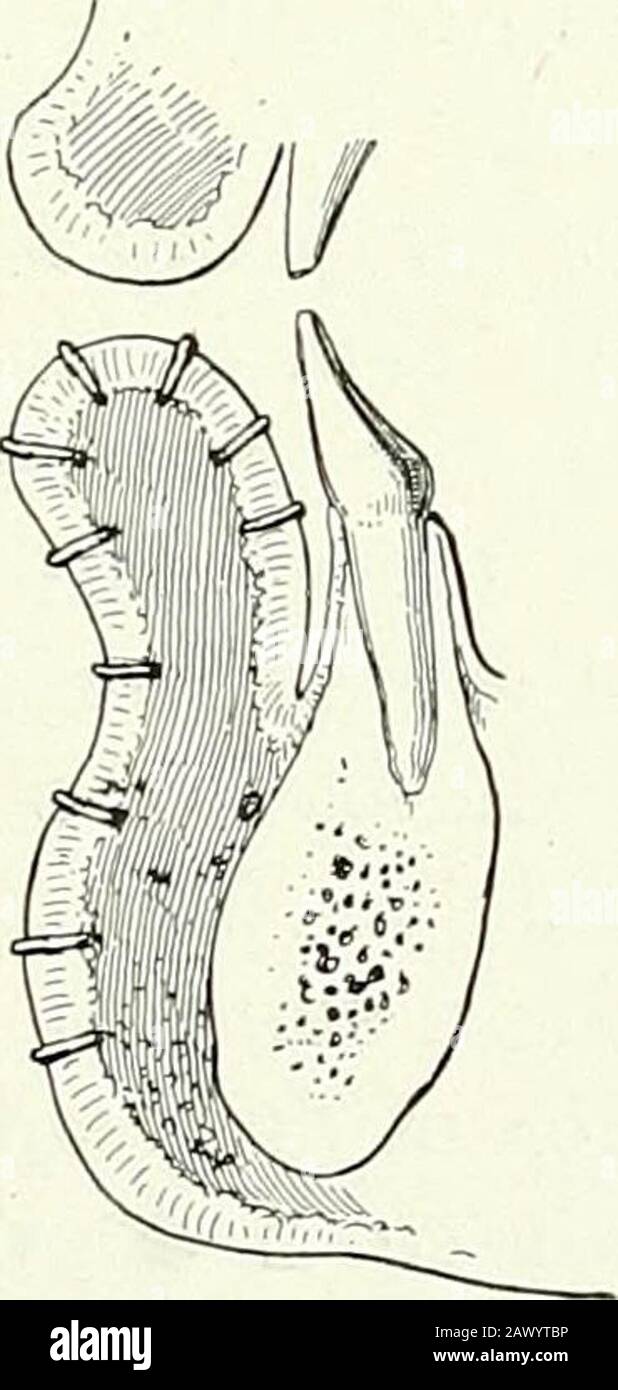 Surgical therapeutics and operative technique . 4r Fig. 48.—V-Resection ...