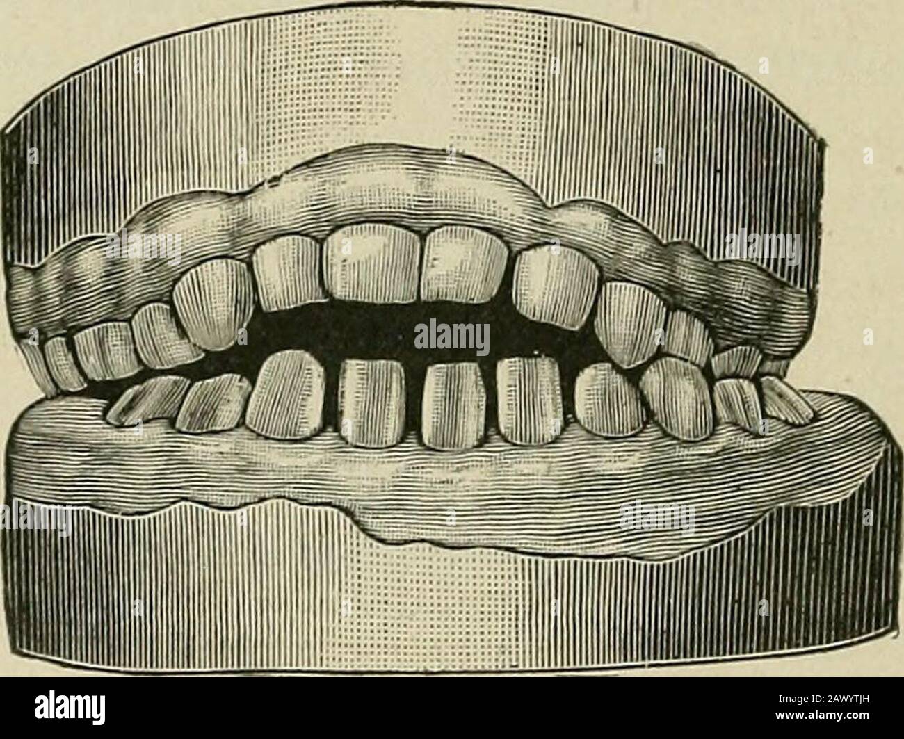 Germs of the permanent teeth hi-res stock photography and images - Alamy