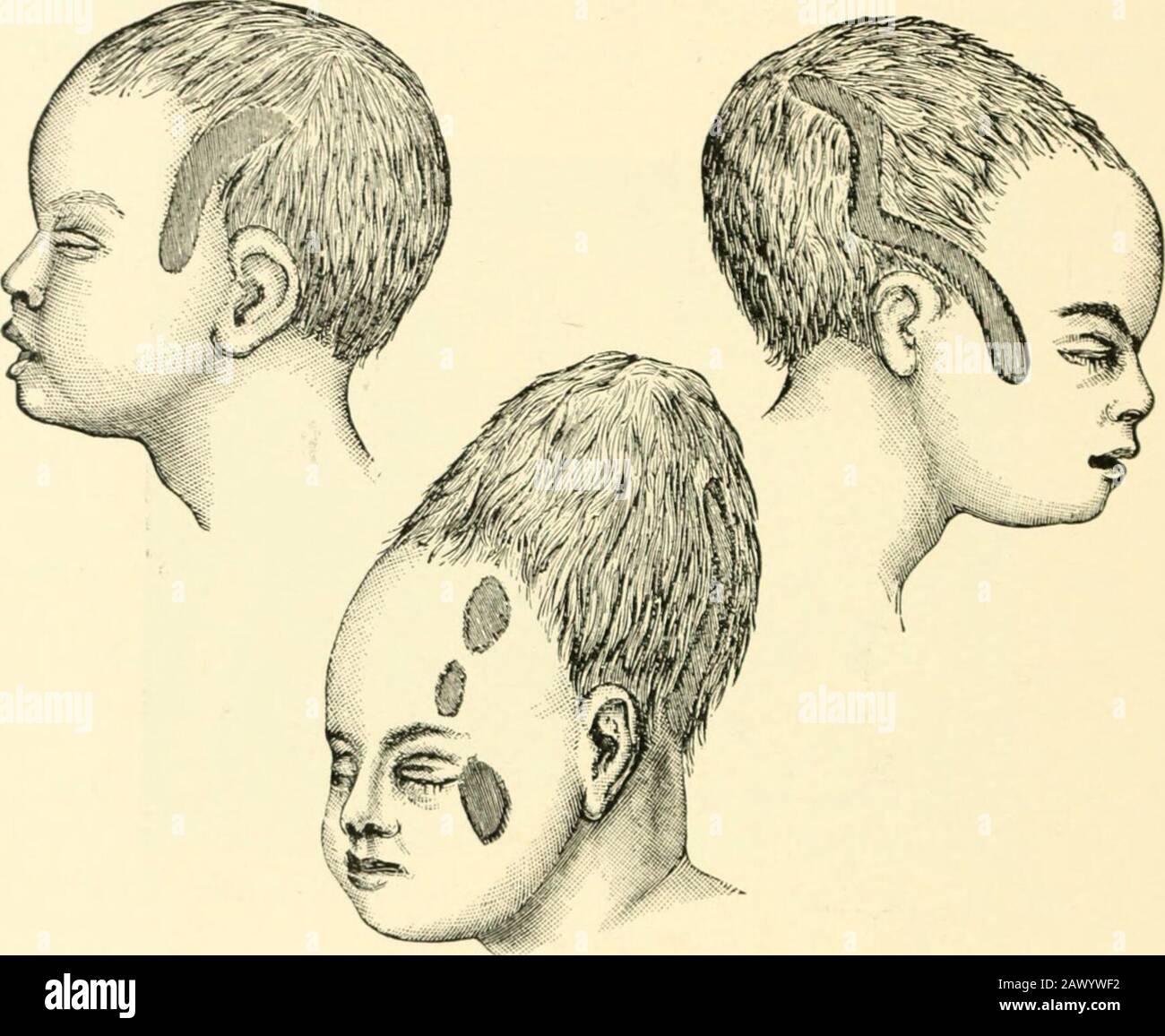 A textbook of obstetrics . s on the rim of the pubic bones, and ...