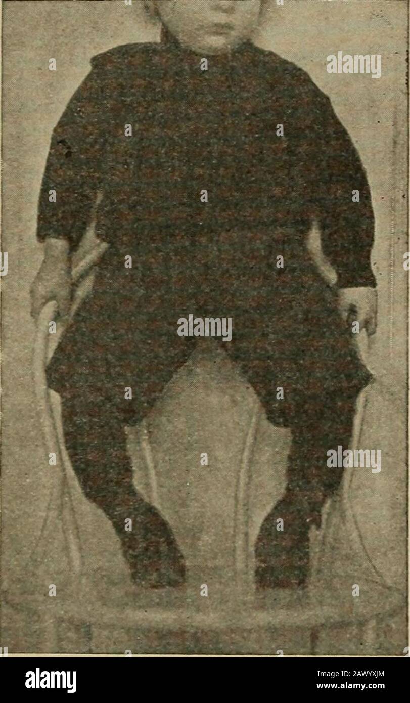 Treatment of scurvy hi-res stock photography and images - Alamy