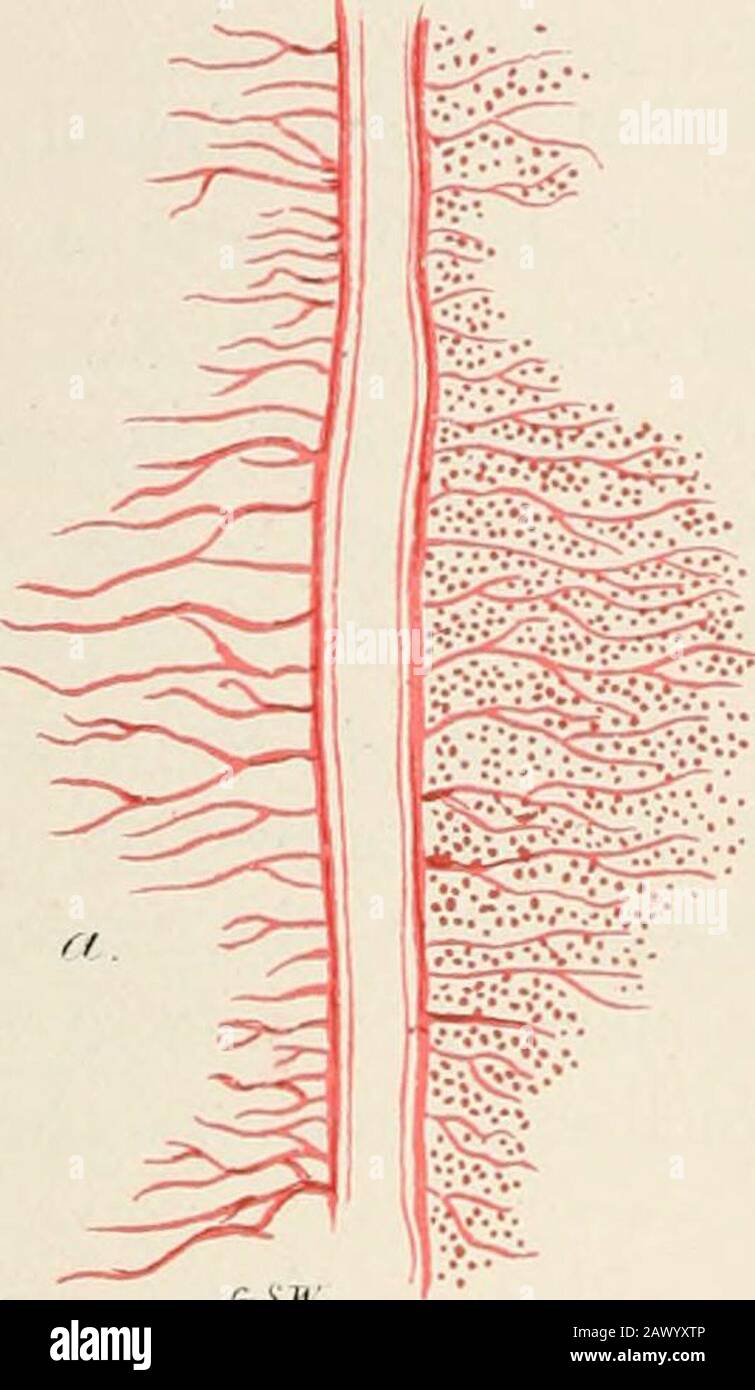 Types Of Trabeculae Carneae