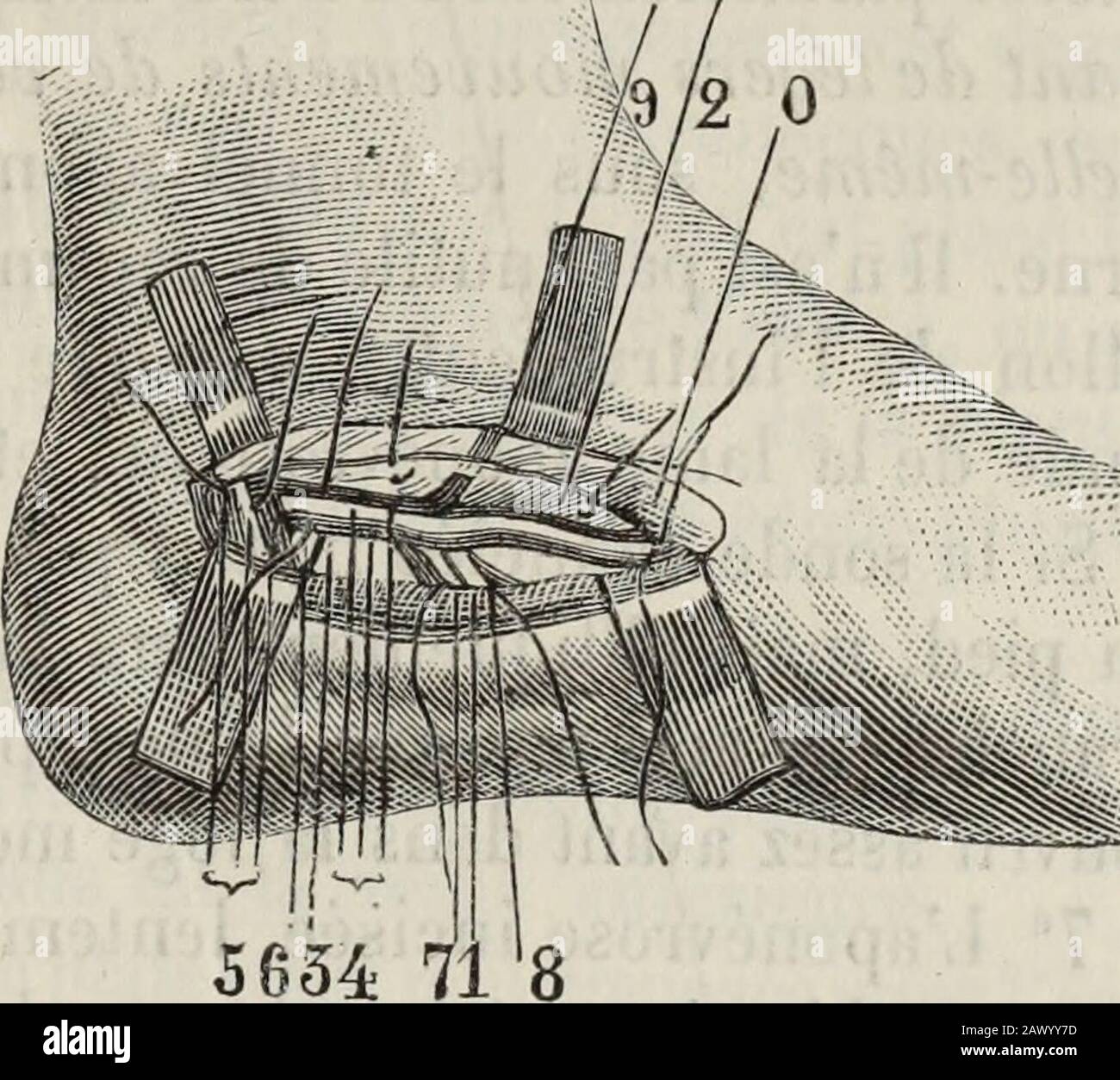 1er de ligne hi-res stock photography and images - Alamy