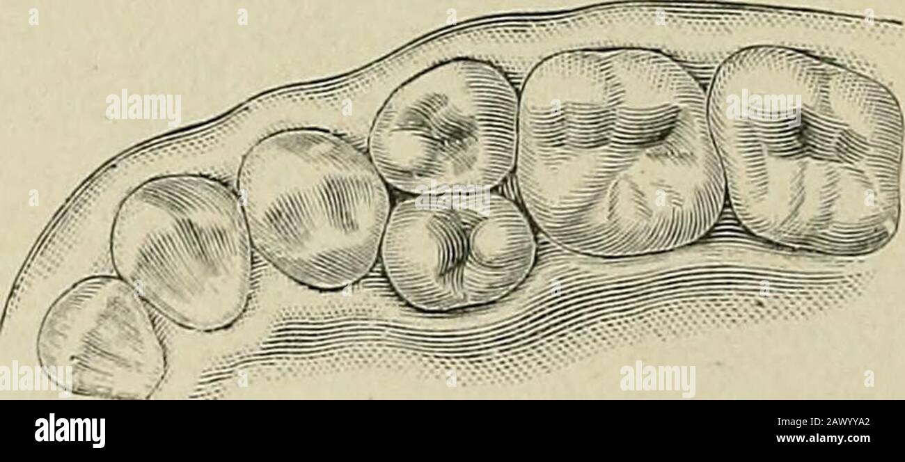 The etiology of osseous deformities of the head, face, jaws and teeth ...