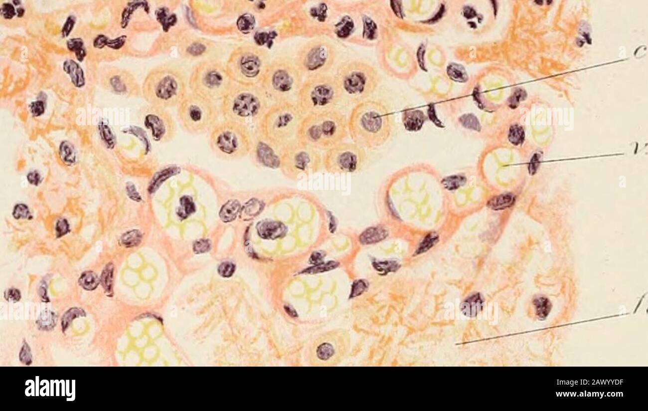 Practical pathology; a manual for students and practitioners . ¢ â /â¢â ...