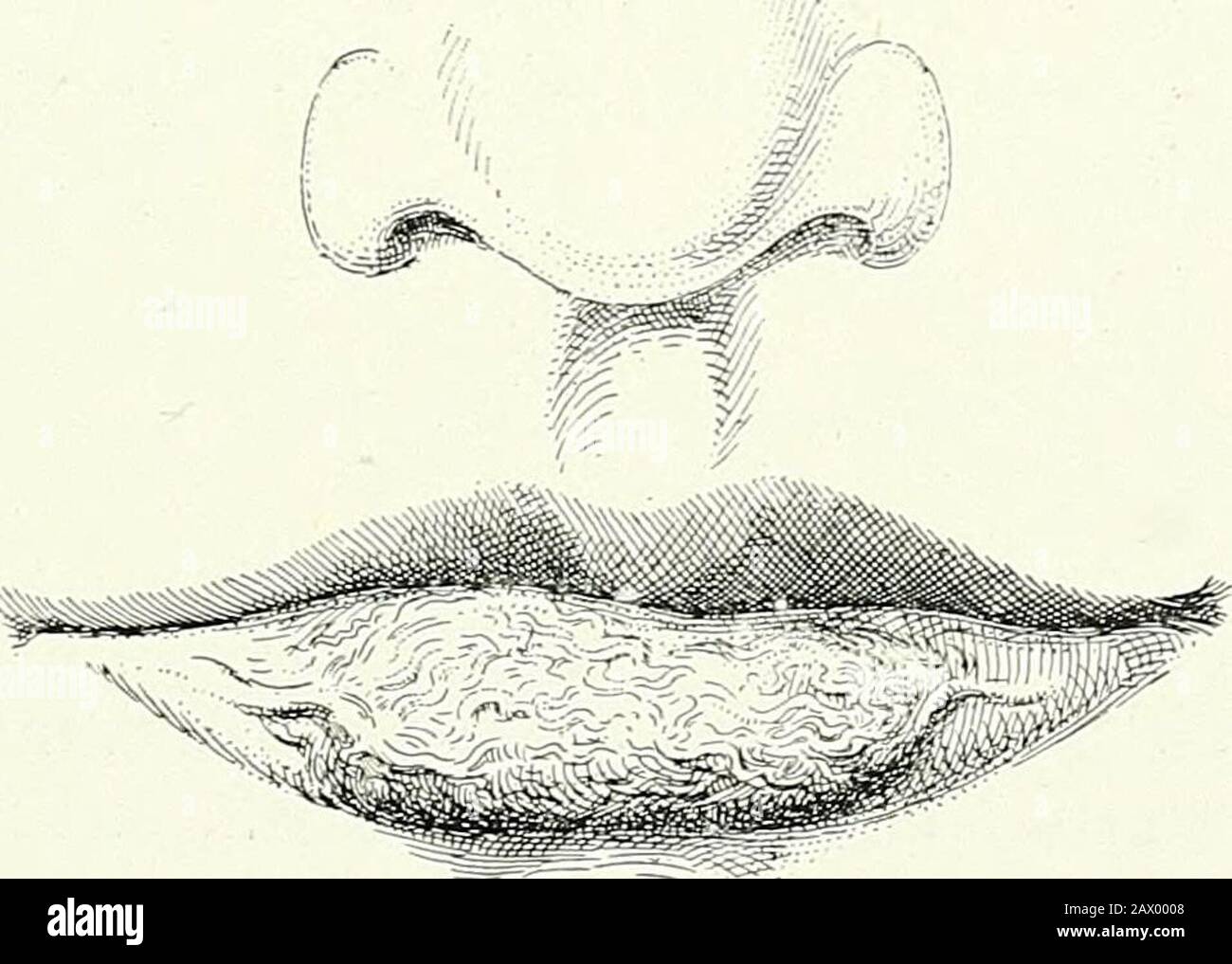 Surgical therapeutics and operative technique . res. Cicatricial ...