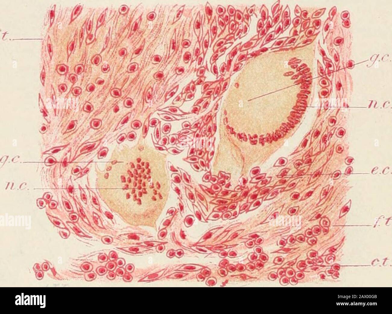 Peribronchial hi-res stock photography and images - Alamy