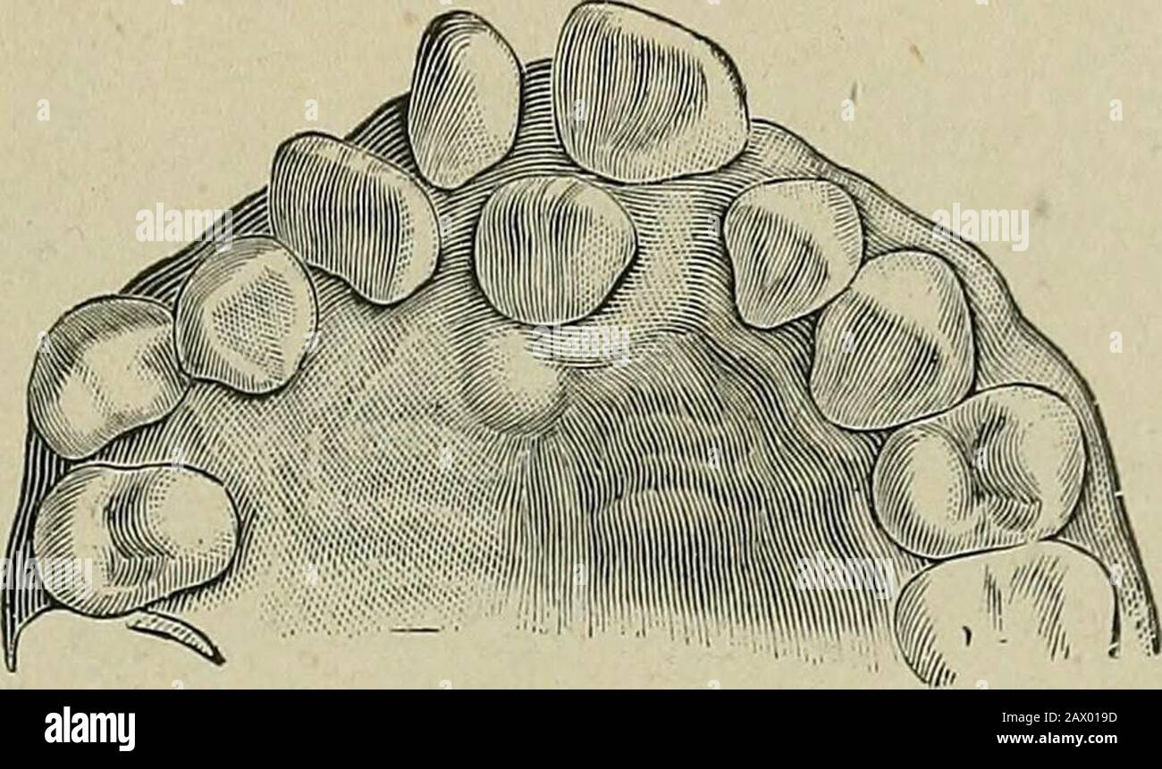 Supernumerary teeth hi-res stock photography and images - Alamy