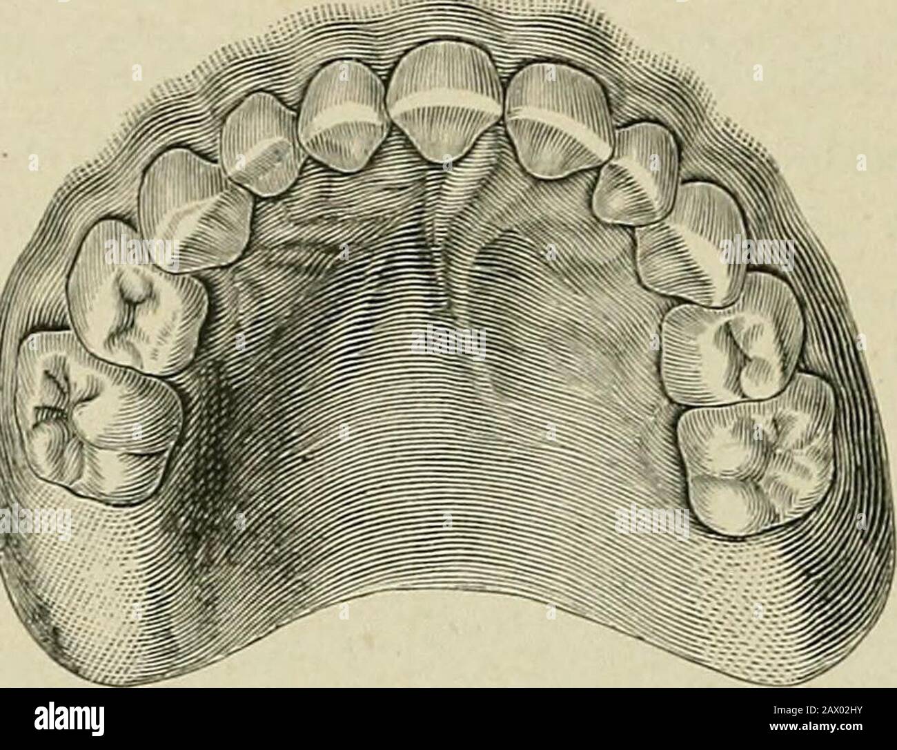 The etiology of osseous deformities of the head, face, jaws and teeth ...