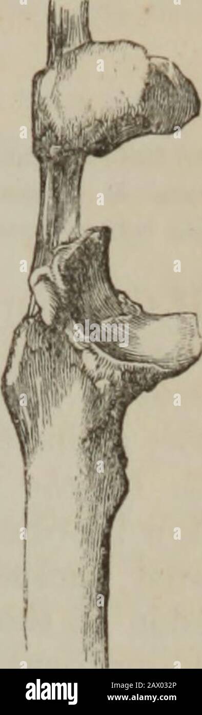 The practice of surgery . the Humerus. 1. Of the Internal Condyle.—The ...