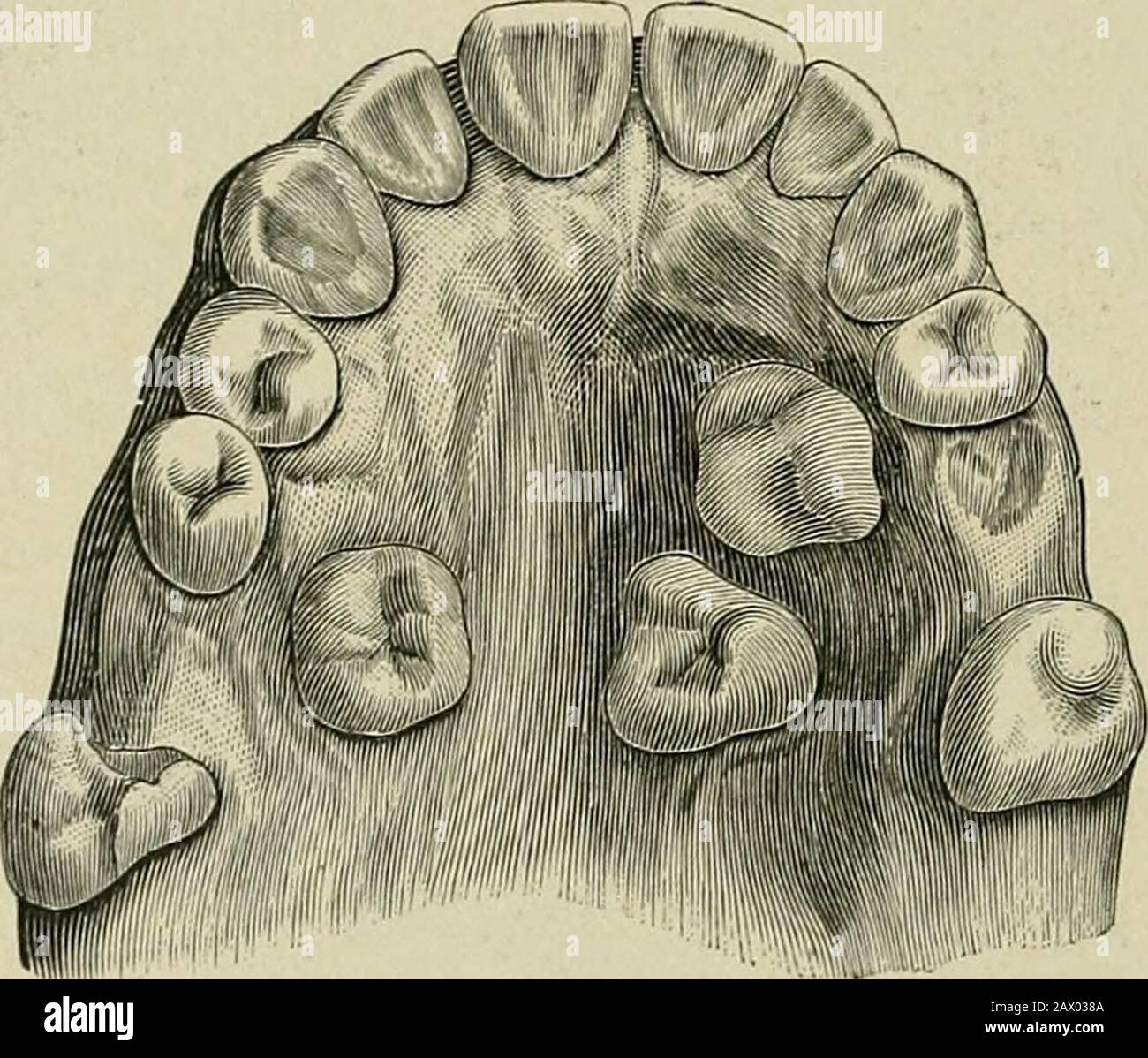 Bone deformities hi-res stock photography and images - Alamy