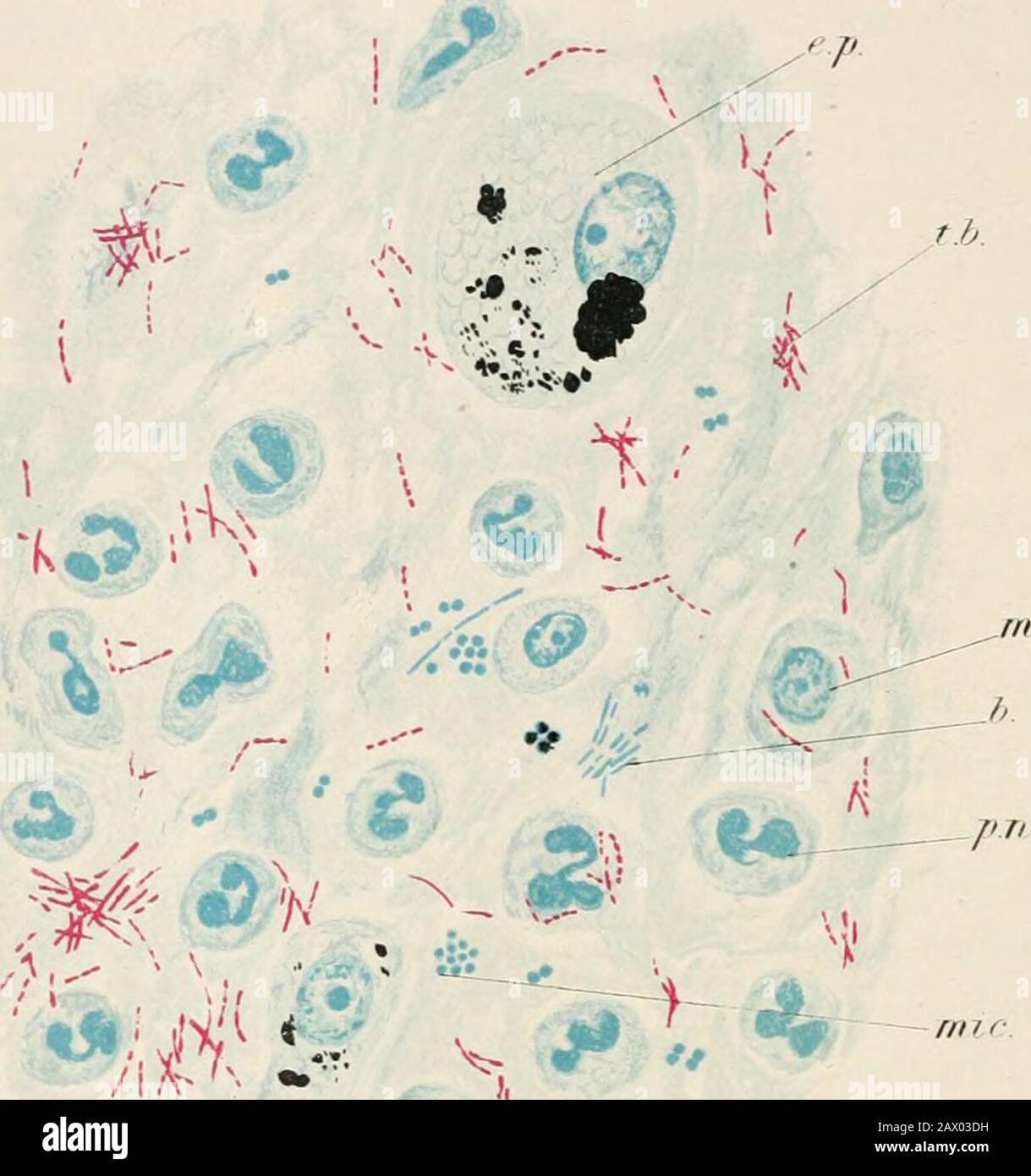 Bacilli tuberculosis hi-res stock photography and images - Alamy