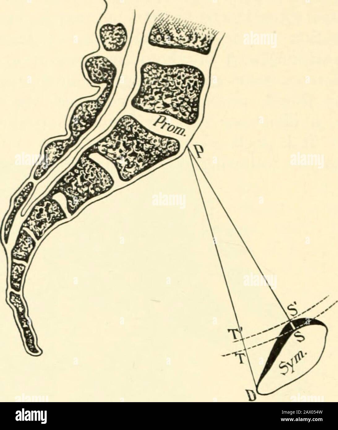 Iagonal hi-res stock photography and images - Alamy