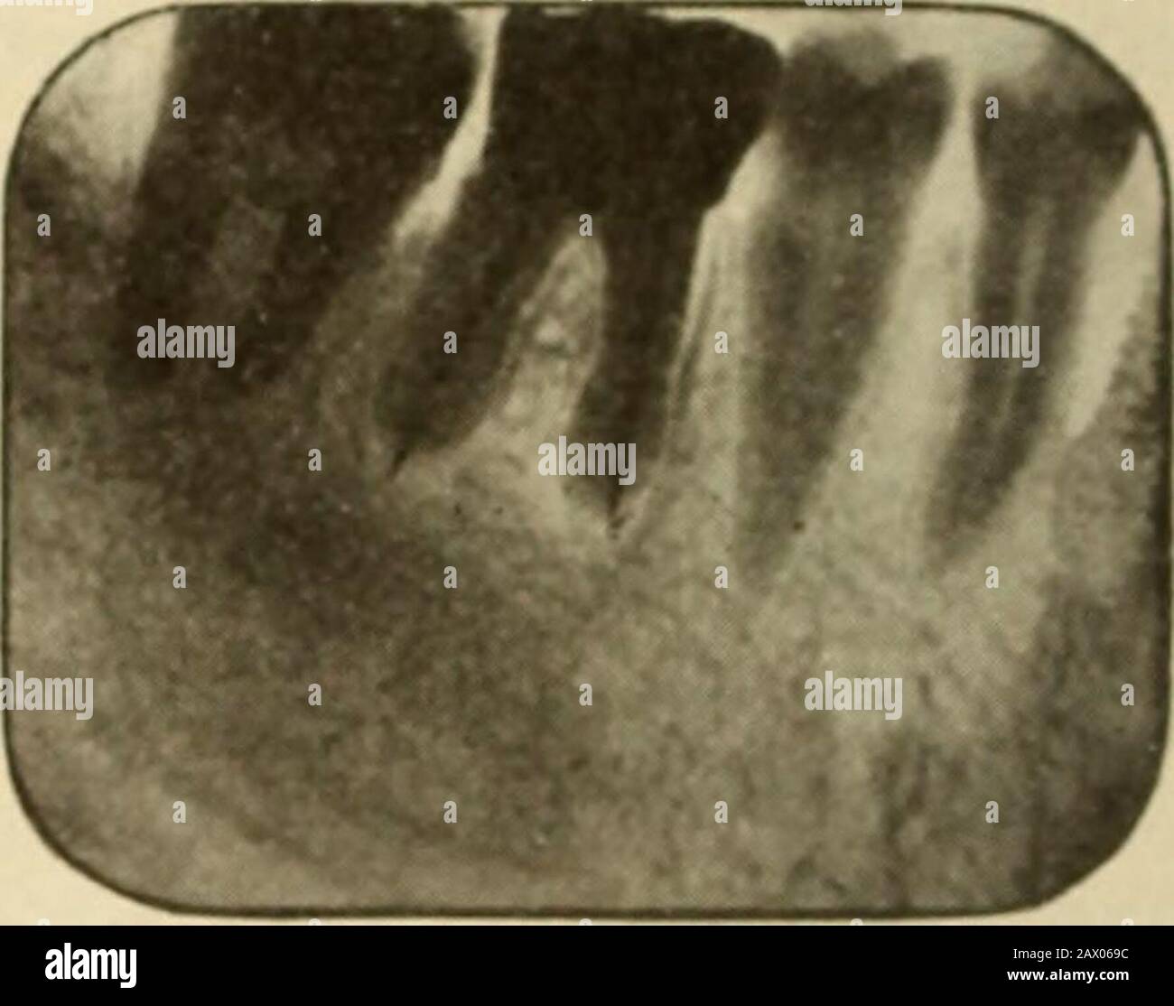 Diseases of the soft structures of the teeth and their treatment; a ...