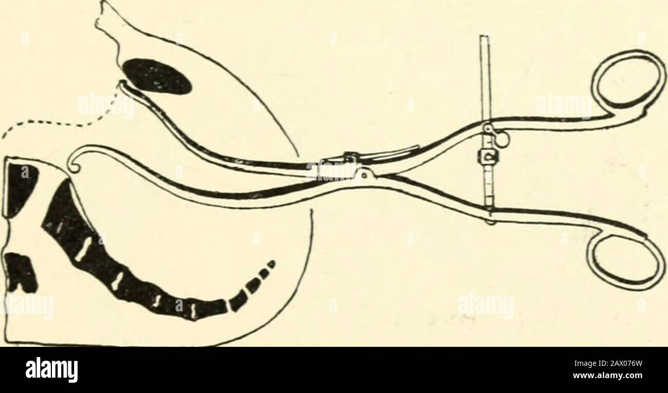 A textbook of obstetrics . , instead >>i from tin- depression below it ...