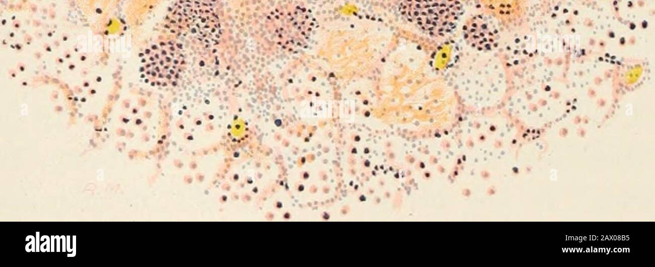 Blood stained walls hi-res stock photography and images - Alamy