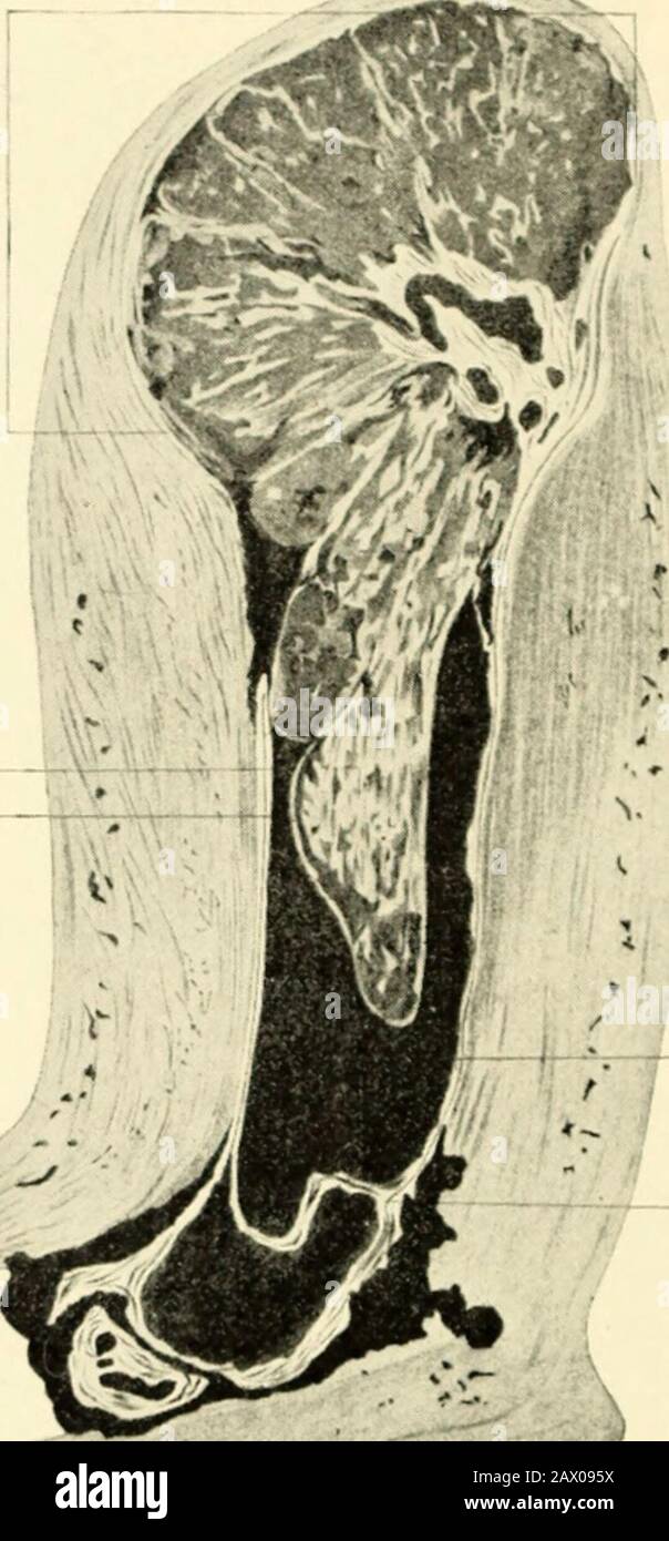 Varnier hi-res stock photography and images - Alamy