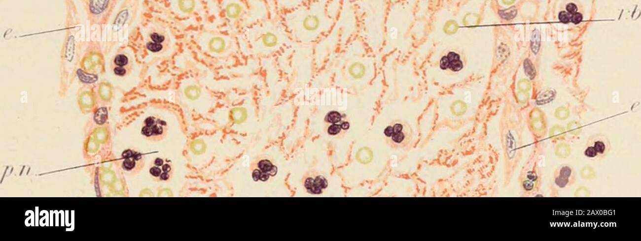 Blood stained walls hi-res stock photography and images - Alamy