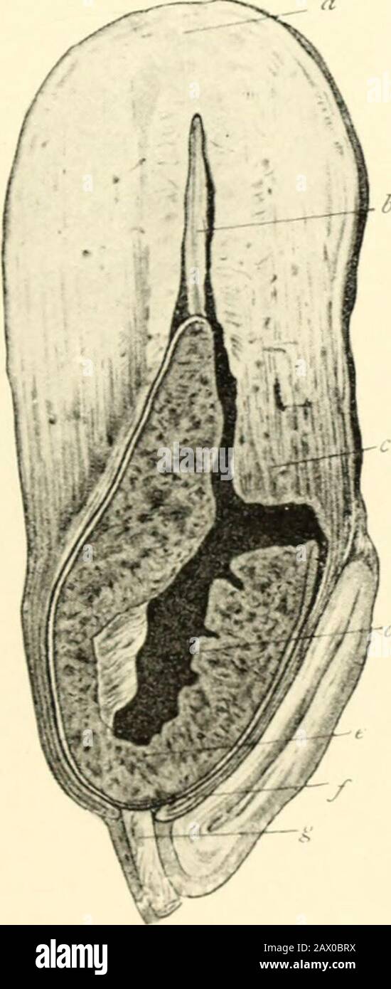 A textbook of obstetrics . e transverse position is convertedinto a ...