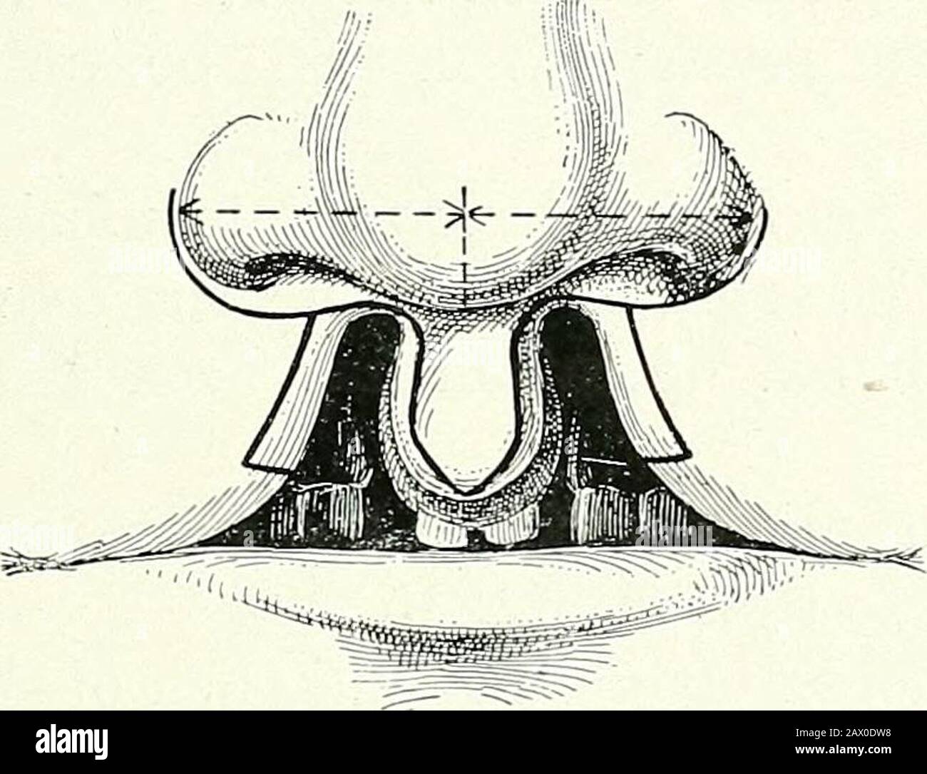 Lip of a hare hi-res stock photography and images - Alamy