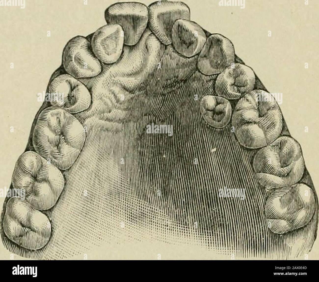 The etiology of osseous deformities of the head, face, jaws and teeth ...