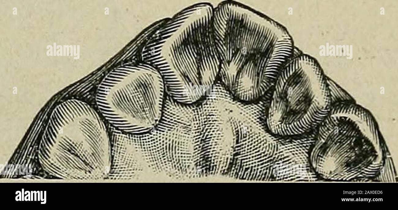 The etiology of osseous deformities of the head, face, jaws and teeth ...