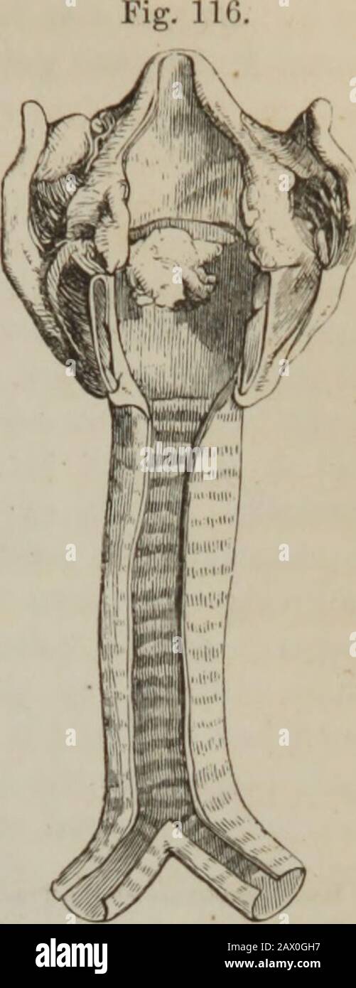 Oedema of larynx hi-res stock photography and images - Alamy