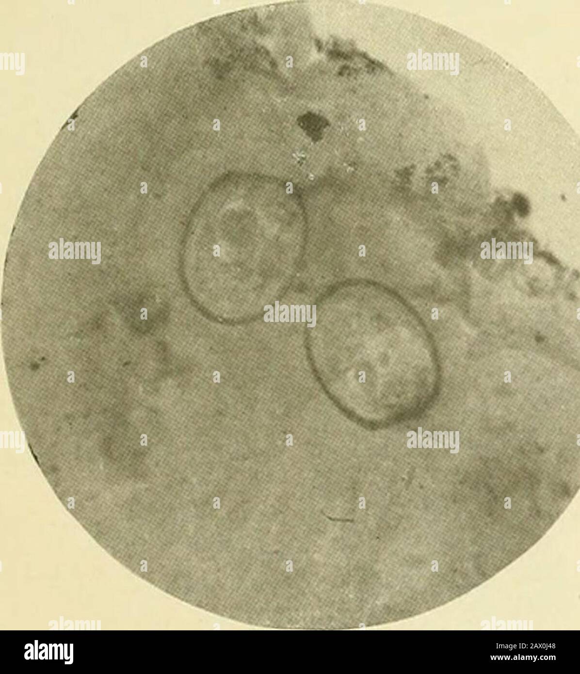 Fish gill filaments hi-res stock photography and images - Alamy