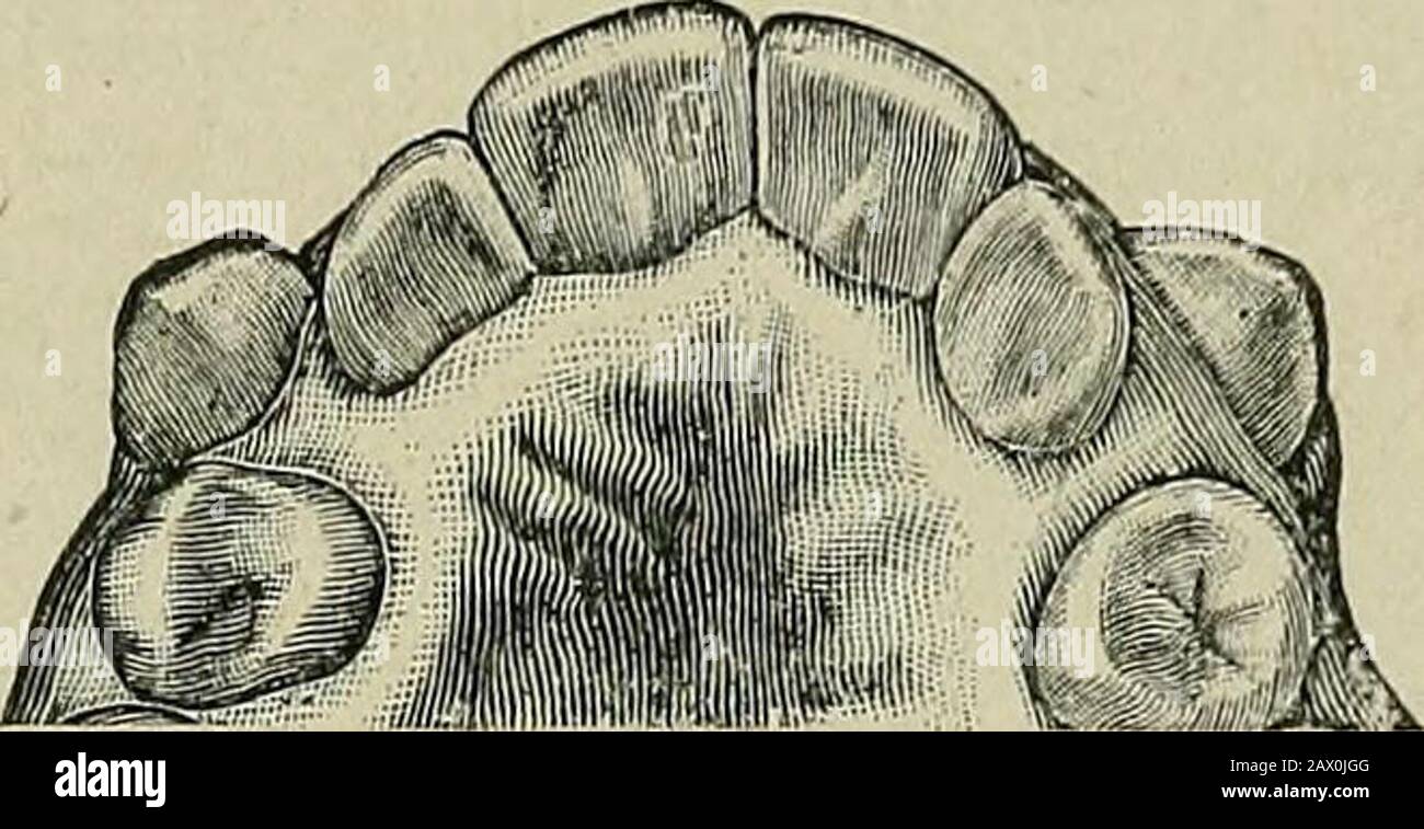 Pinched Face High Resolution Stock Photography and Images - Alamy