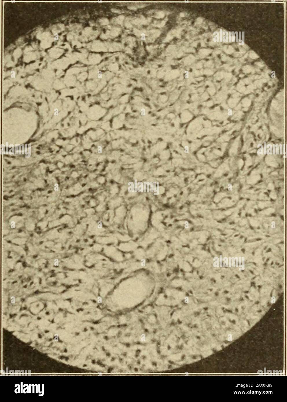 Diseases of the soft structures of the teeth and their treatment; a ...