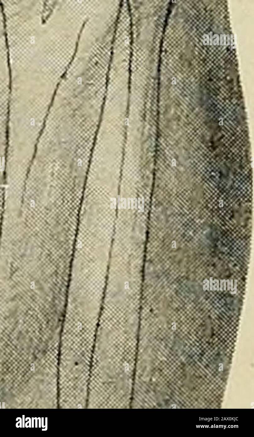 Interpubic High Resolution Stock Photography and Images - Alamy