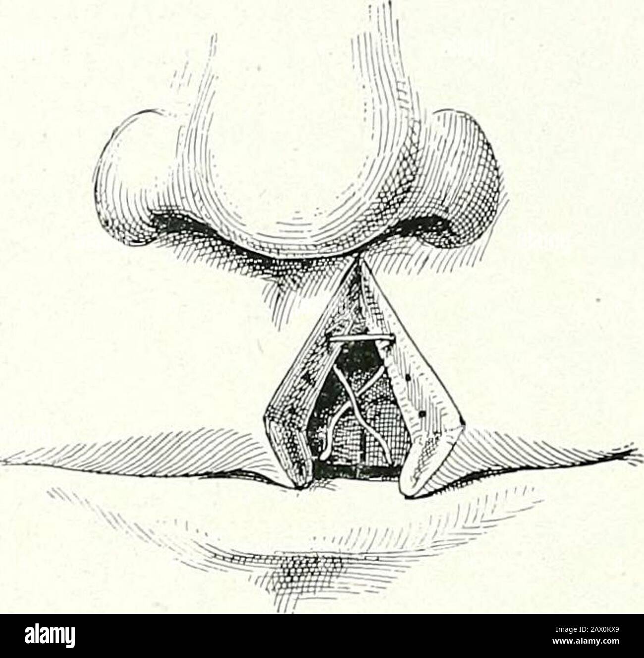 Lip of a hare hi-res stock photography and images - Alamy