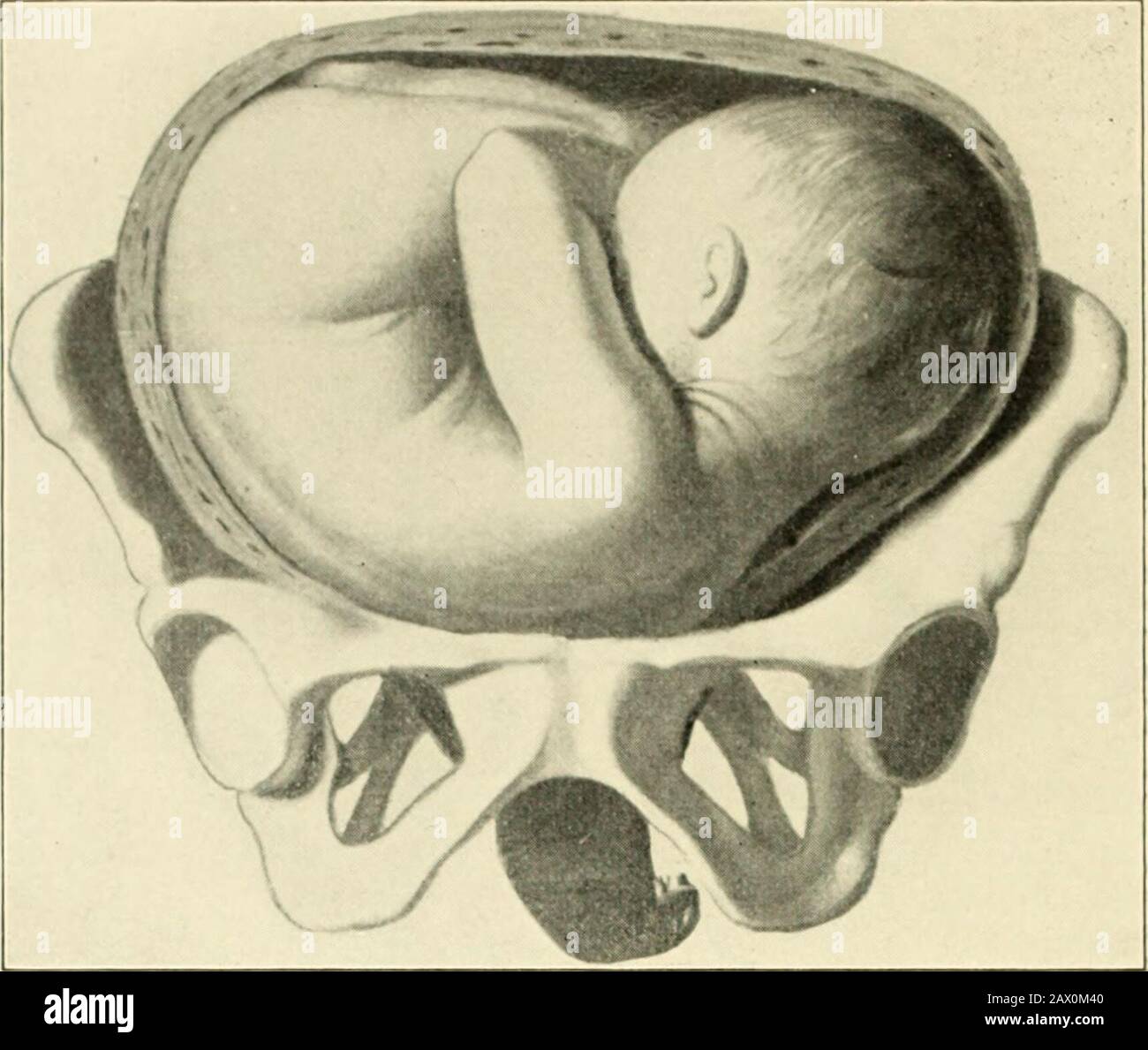 Shoulder Presentation