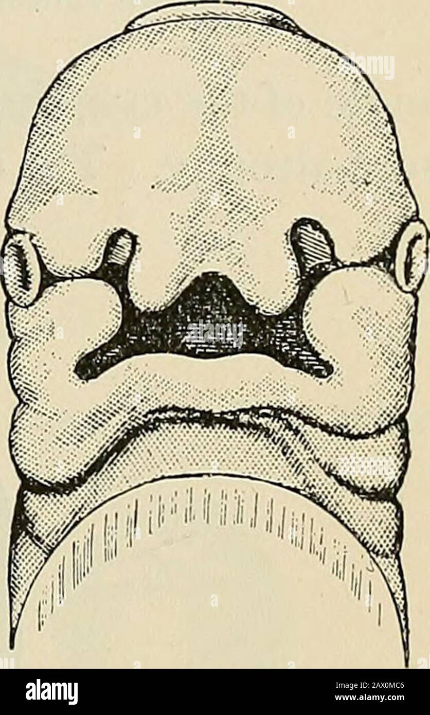 The pathology and surgical treatment of tumors . d gives rise to a ...