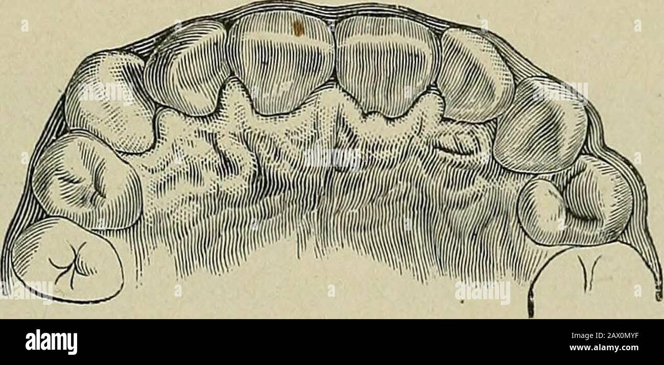 Germs of the permanent teeth hi-res stock photography and images - Alamy