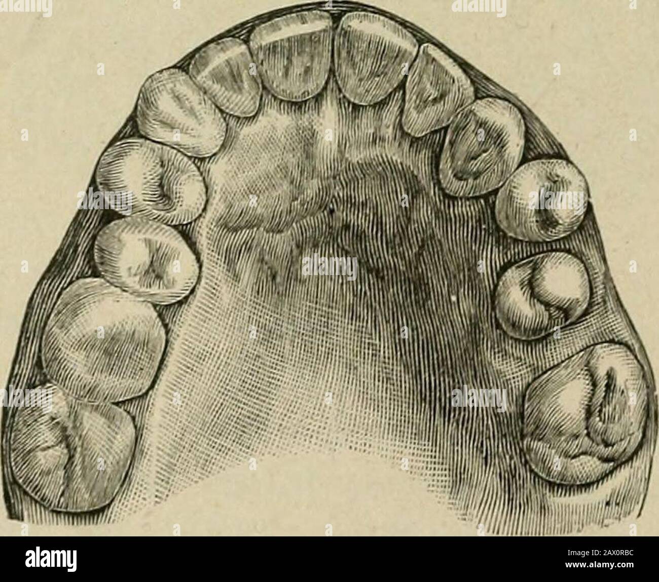 The etiology of osseous deformities of the head, face, jaws and teeth ...