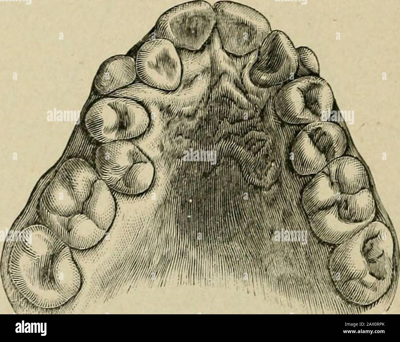 The etiology of osseous deformities of the head, face, jaws and teeth ...