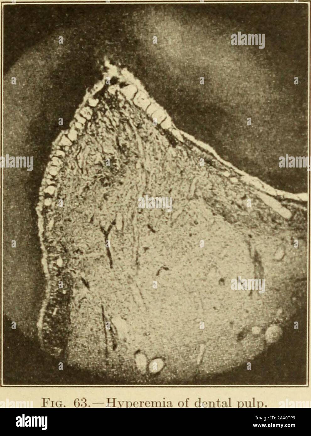 Diseases of the soft structures of the teeth and their treatment; a ...