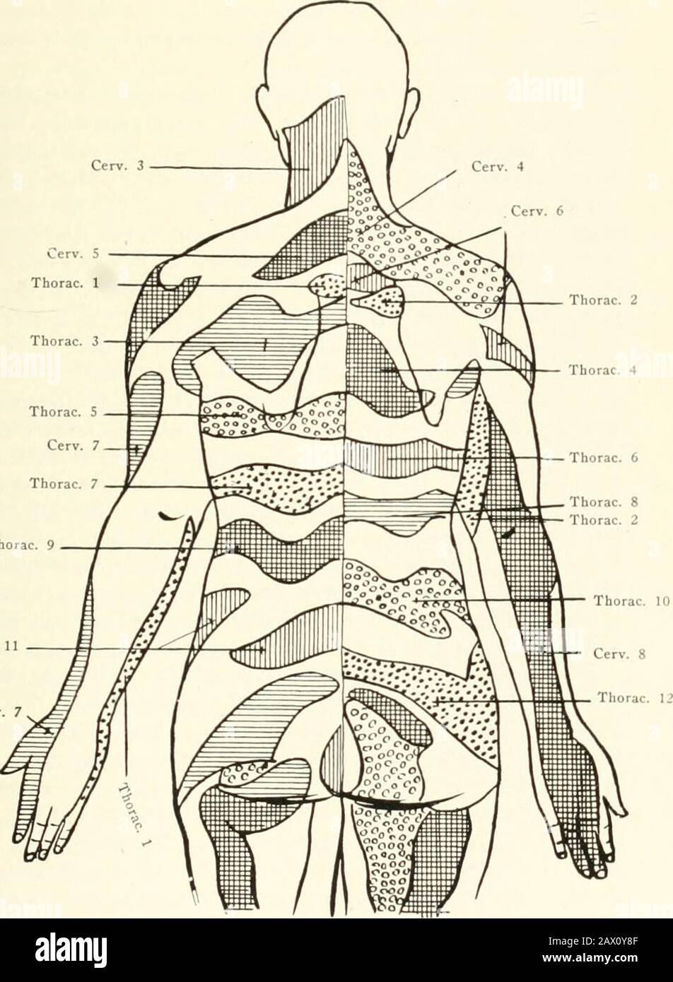 Clinical tuberculosis . Fig. 27.—Heads zones. (Anttrior surface of the ...