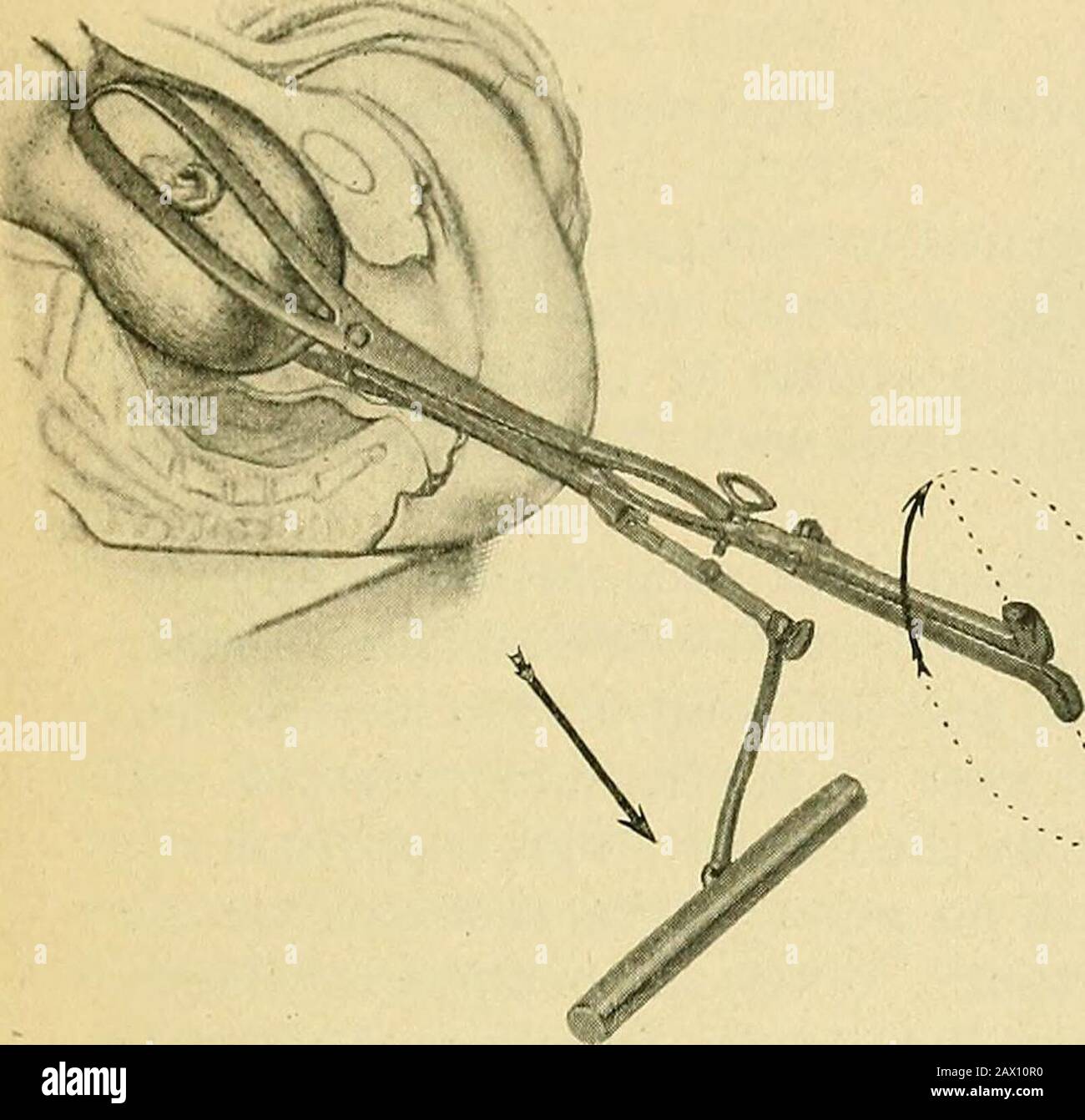 The practice of obstetrics, designed for the use of students and ...