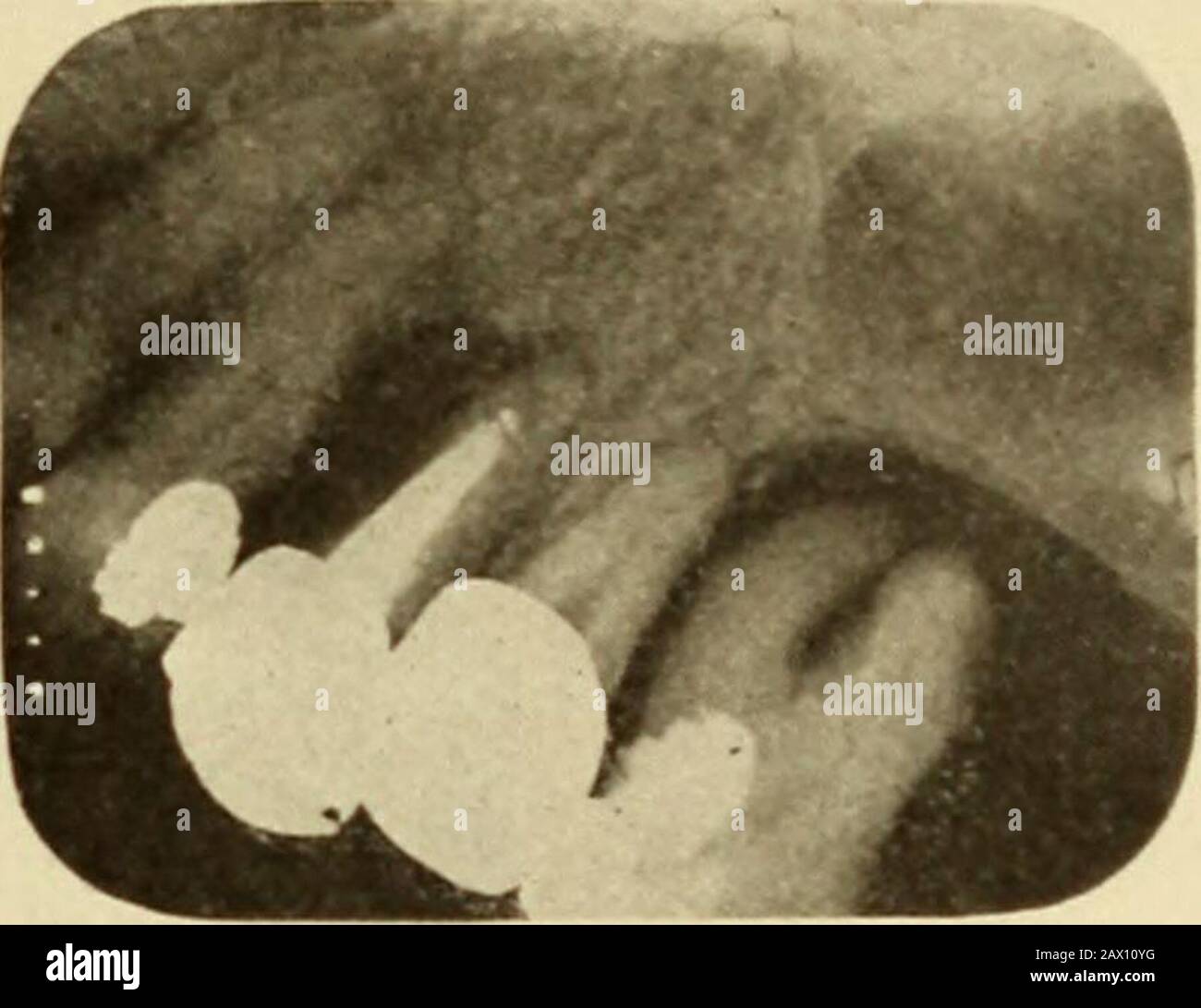 Diseases of the soft structures of the teeth and their treatment; a ...