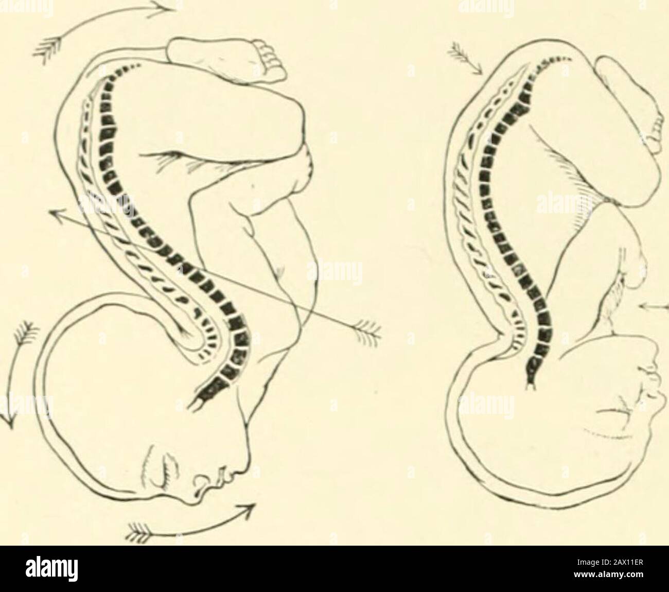 Occiput anterior hi-res stock photography and images - Alamy