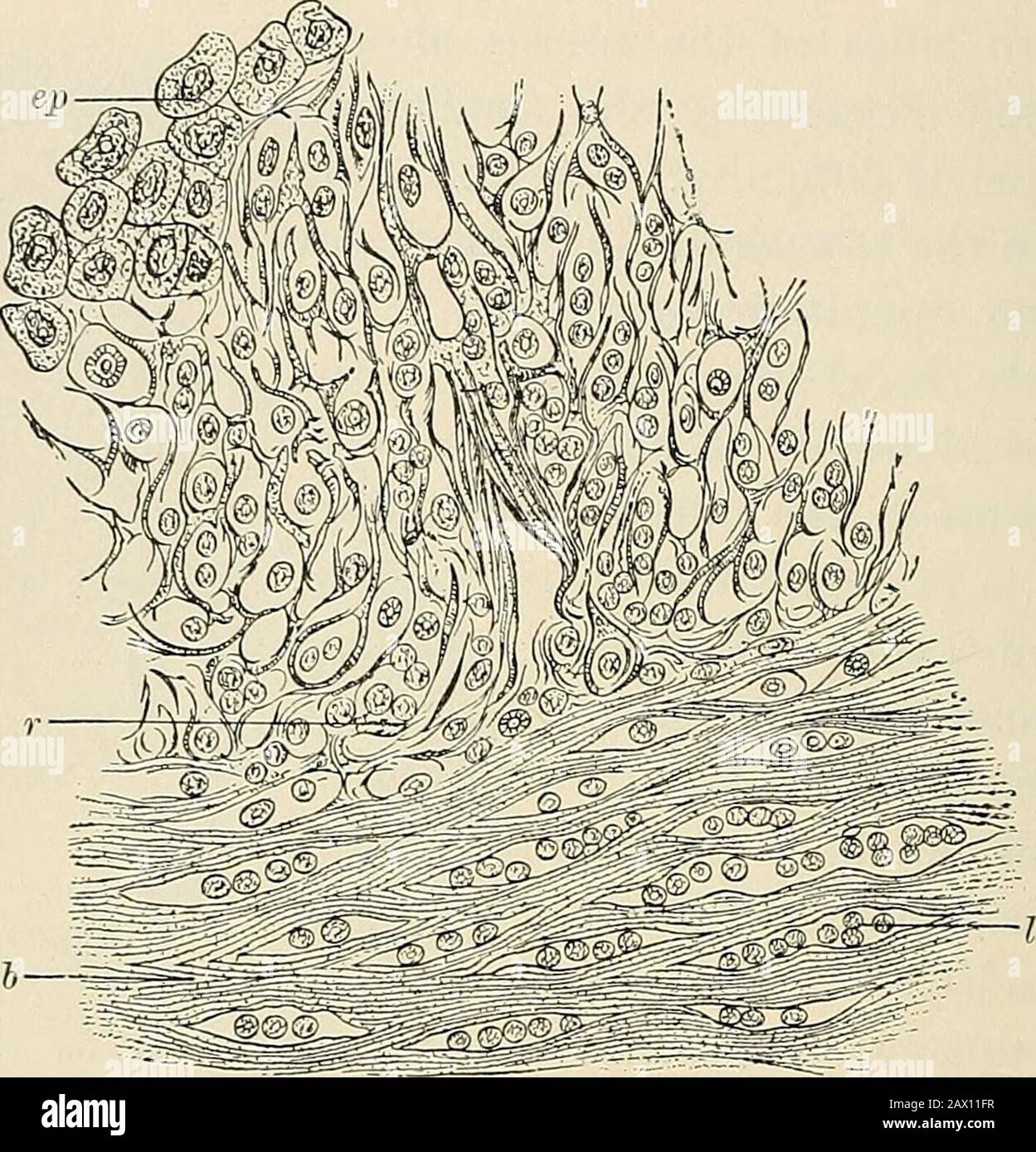 Spindle cell sarcoma hi-res stock photography and images - Alamy